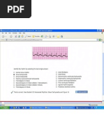 AHA ACLS Post Test Answer Key 2023 | PDF | Cardiopulmonary ...
