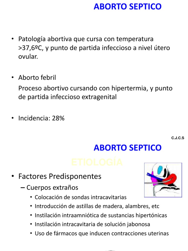 ABORTO SEPTICO. | Septicemia | Aborto espontáneo