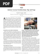 PSLD Surgery Procedure Overview | PDF | Vertebra | Anatomical Terms Of ...