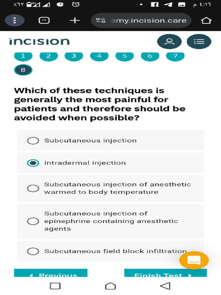 Local Infiltration and Field Block Anesthesia 3 Models | PDF