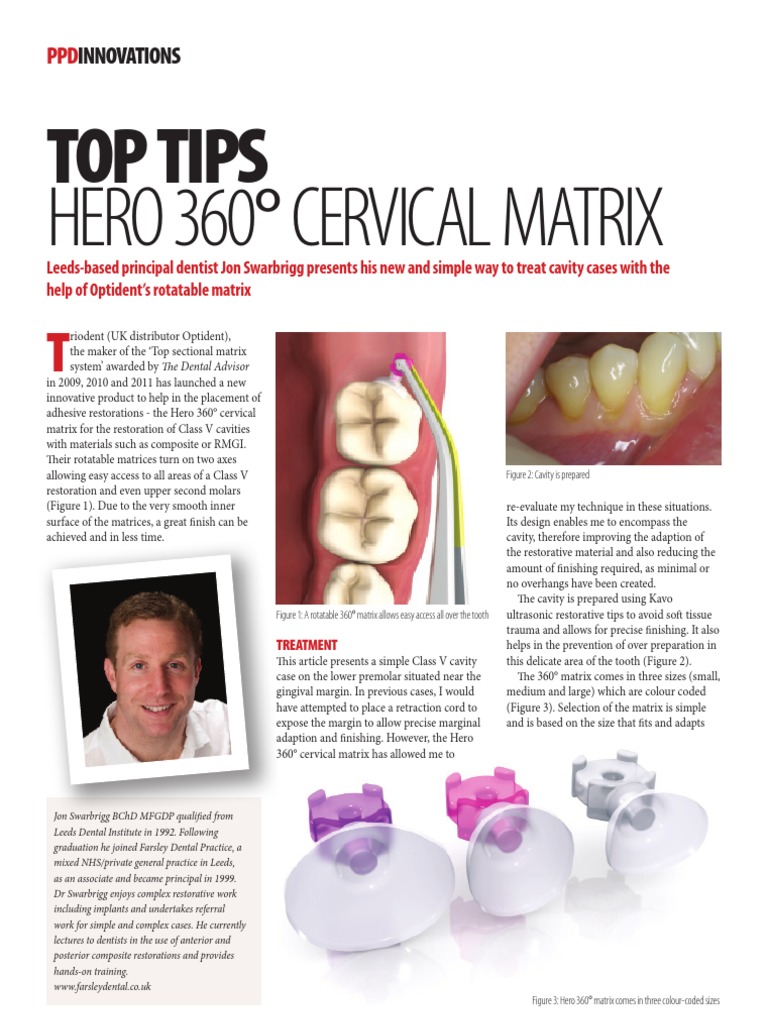 PPD July Top Tip - Cervical Matrix | PDF | Composite Material | Matrix ...