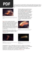 VA Conversion Chart | PDF | Visual Acuity | Vision