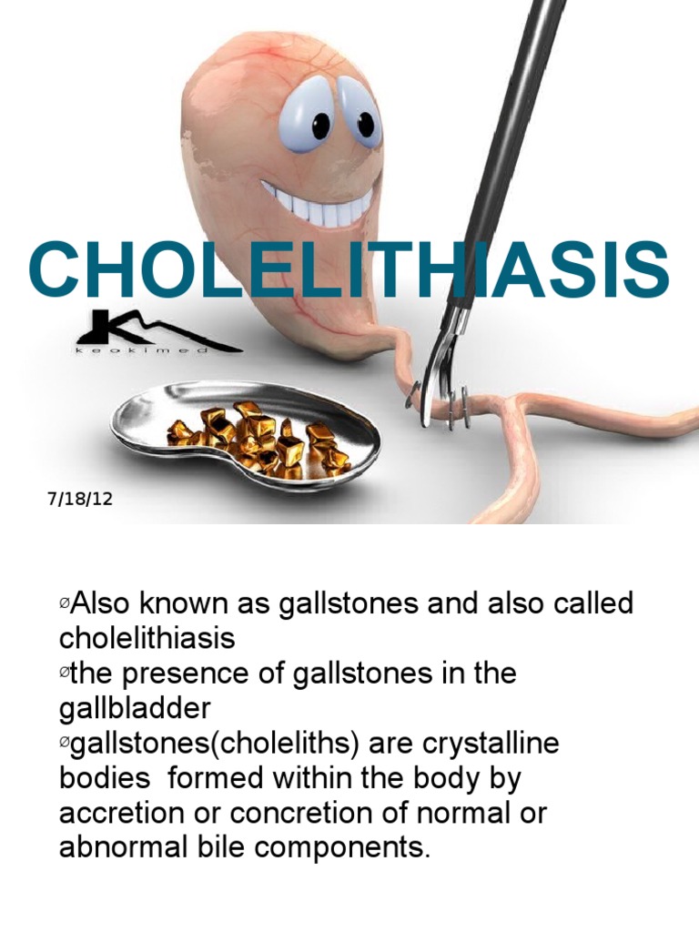 CHOLElithiasis | PDF | Gallbladder | Medical Specialties