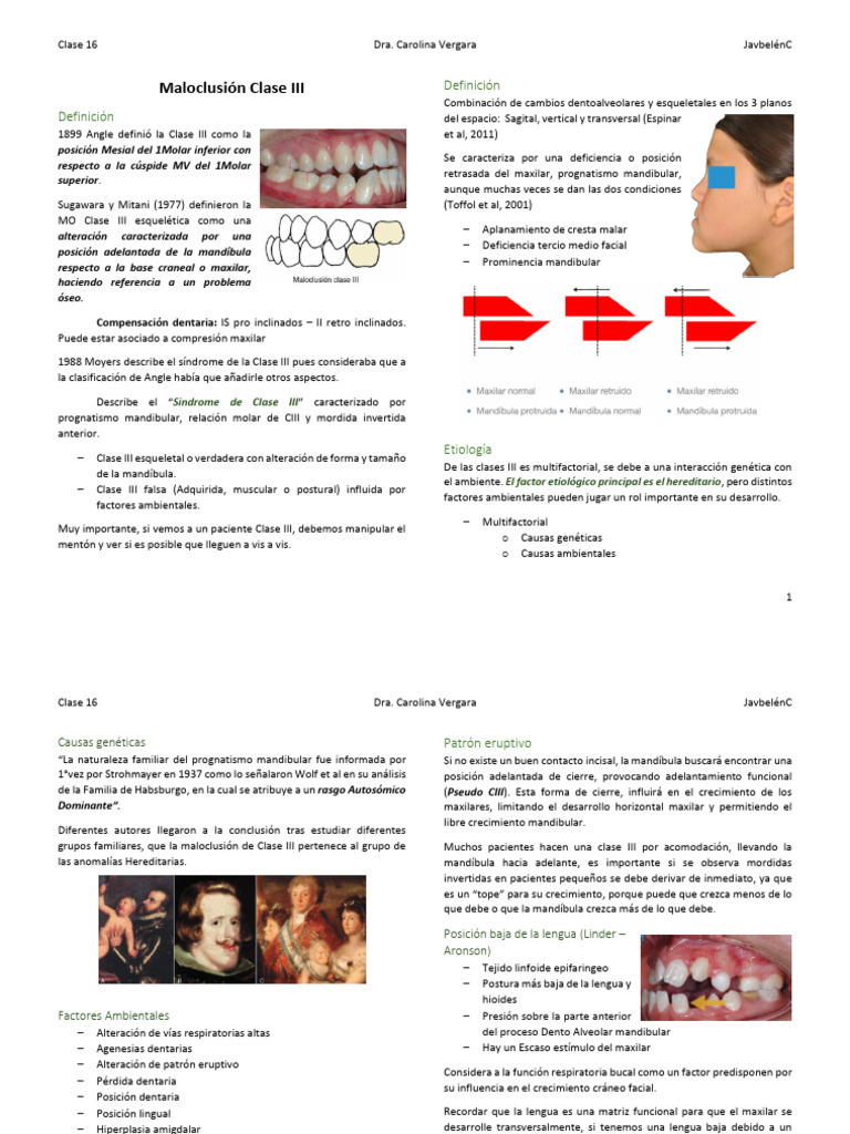 Maloclusión Clase III | PDF | Ortodoncia | Ramas de Odontología