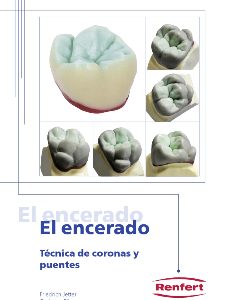 Tecnica de Encerado | PDF