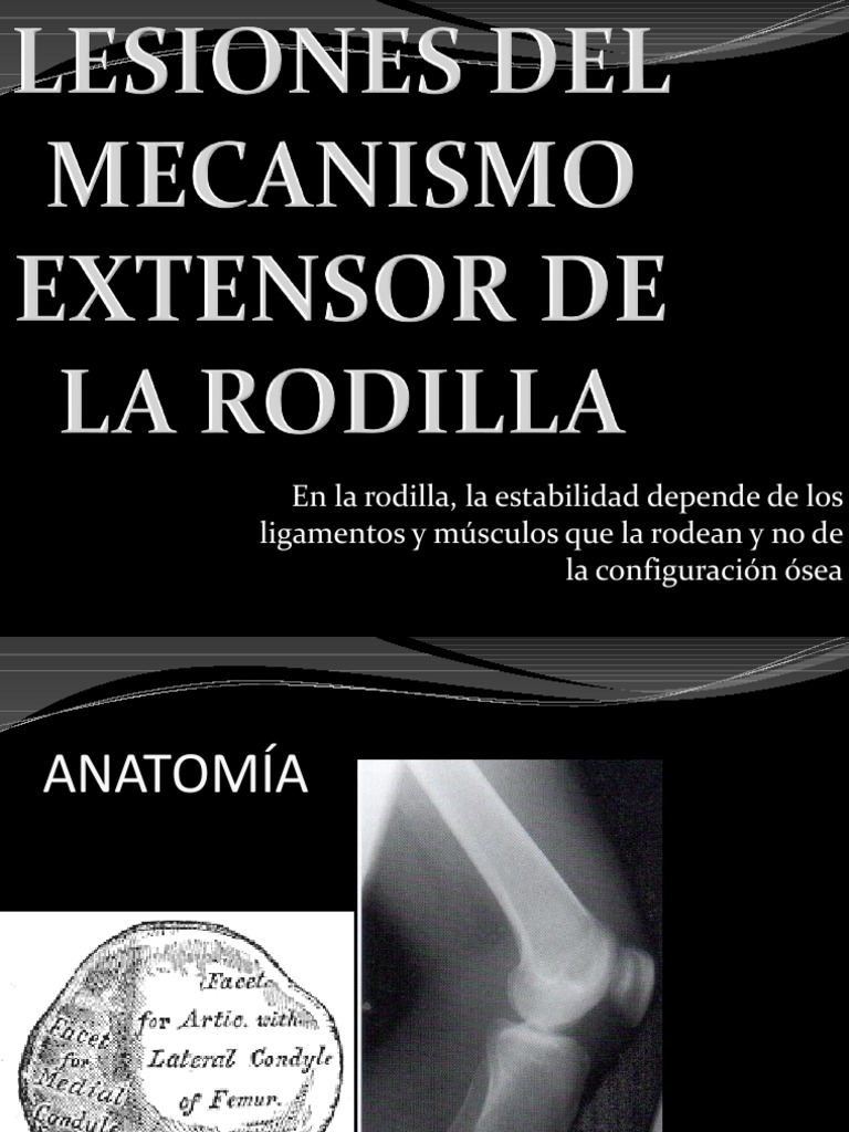 Lesiones Aparato Extensor Rodilla | PDF | Rodilla | Músculo