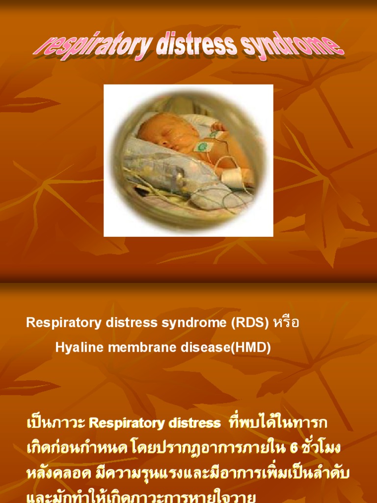 RDS in Pediatrics | PDF