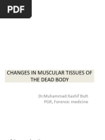Cadaveric Spasm: Forensic Significance | PDF