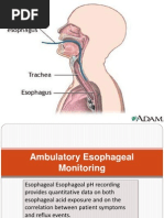Interpreting Bravo PH Studies | PDF | Gastroesophageal Reflux Disease ...