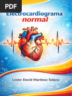 Morfología del Complejo QRS en ECG | PDF | Electrofisiología cardíaca ...