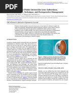 CT LUCIA 602 IOL Specifications and Safety | PDF | Optics | Vision