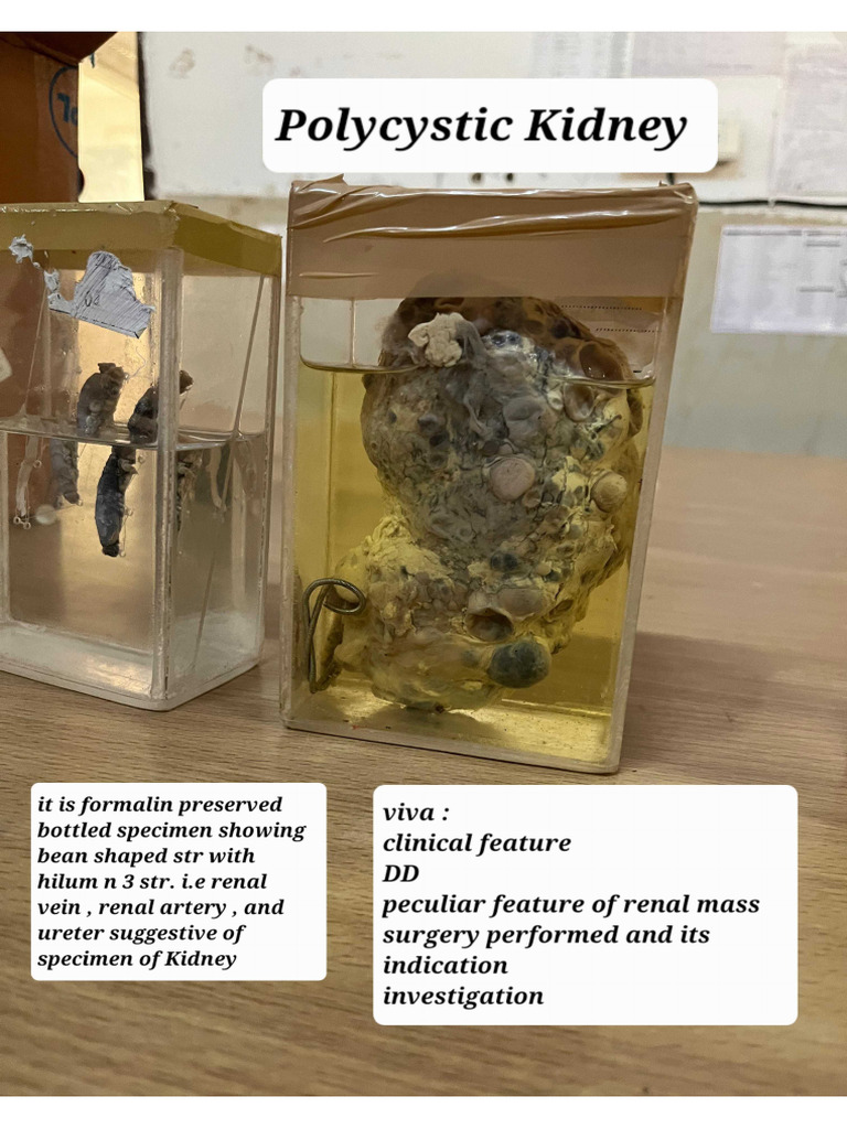 Surgery (specimens) | PDF