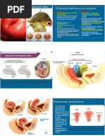 Partes de la Salpinge y Anatomía Asociada | PDF | Ovario | Pelvis