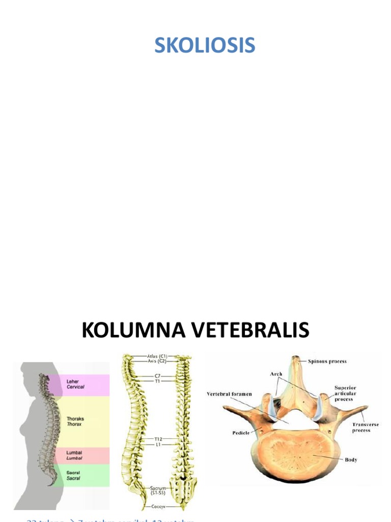 Skoliosis | PDF