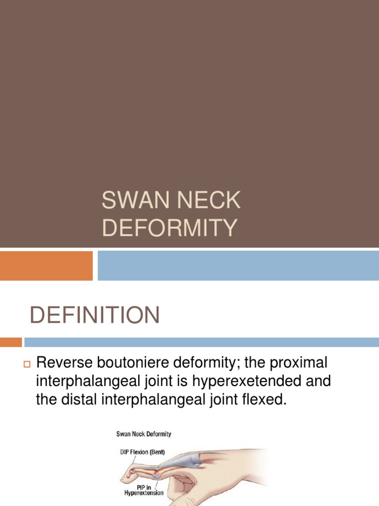 Swan Neck Deformity | PDF | Finger | Anatomical Terms Of Motion