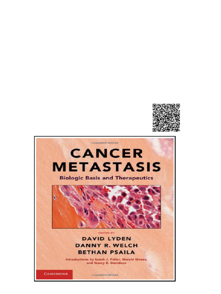 (Ebook) Cancer Metastasis: Biologic Basis and Therapeutics by David ...