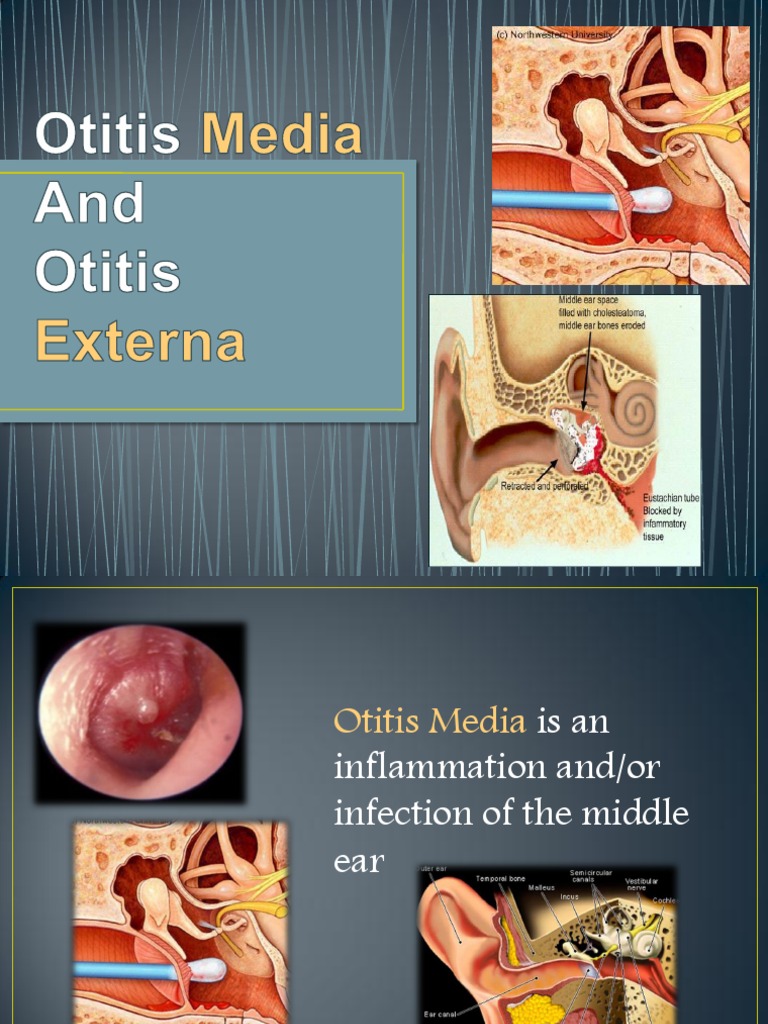 Otitis Media and Externa | PDF | Immunology | Diseases And Disorders