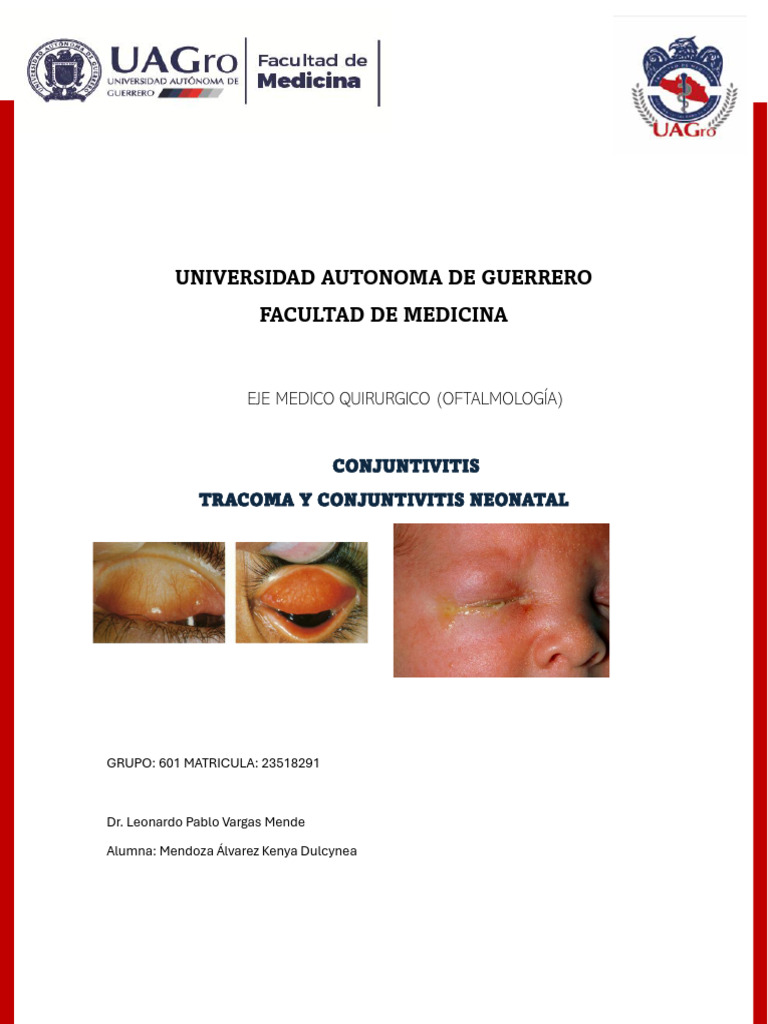 Tracoma y Conjuntivitis Neonatal 1 | PDF | Enfermedades y trastornos ...