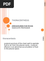 Pleural Fluid Tapping Procedure Guide | PDF | Respiratory System ...