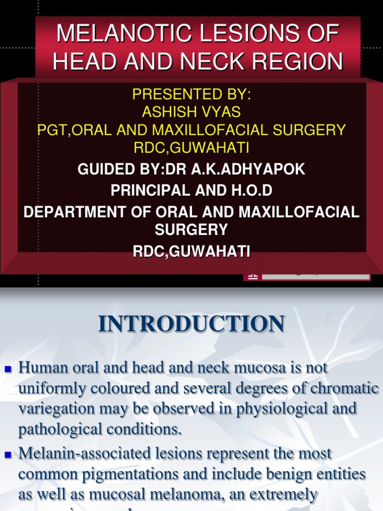 Melanotic Lesions of Head and Neck Region | PDF | Melanoma | Neck