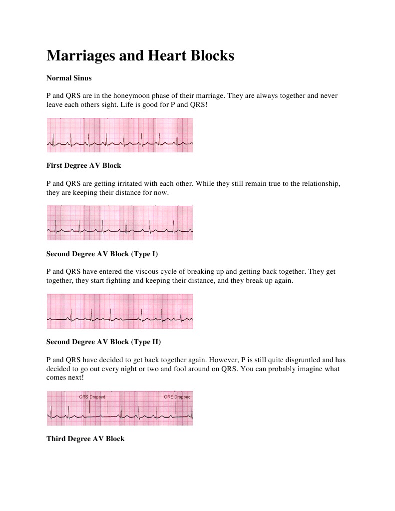 Marriages and Heart Blocks | PDF