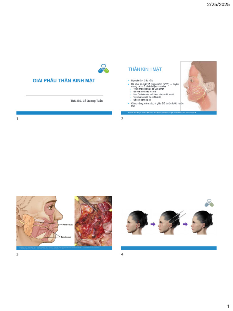Facial Nerve, Surgery Entrance | PDF