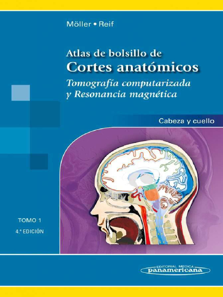 Torsten B Möller, Emil Reif Atlas de Bolsillo de Cortes Anatómicos ...