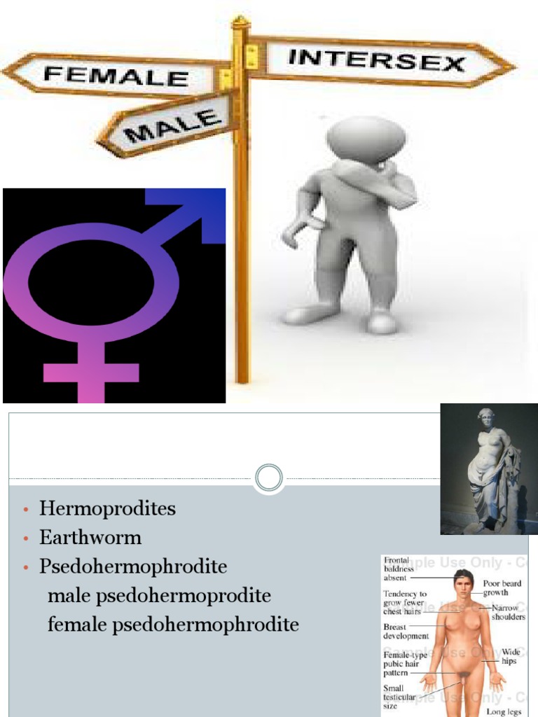 Intersex | Download Free PDF | Intersex | Reproductive System