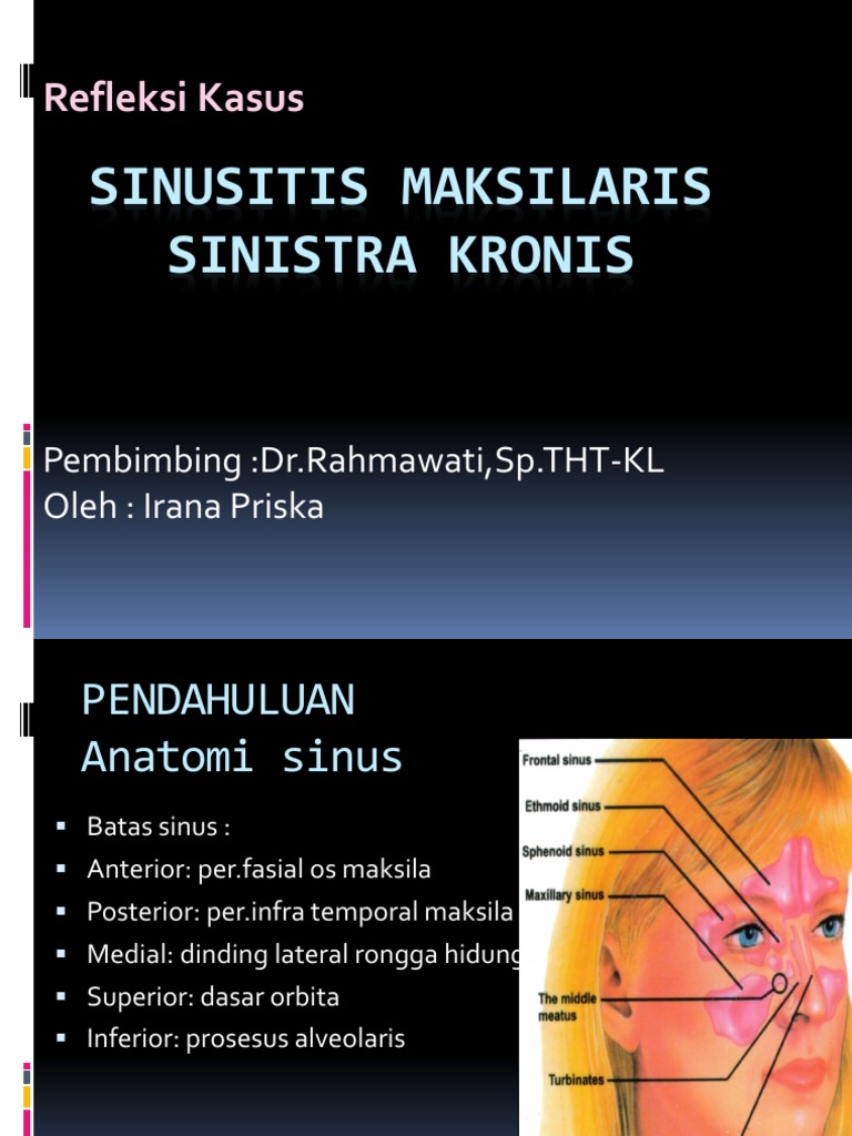 Sinusitis Maksilaris | PDF