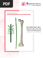 Zimmer Natural Nail System Tibial Nail Surgical Technique | PDF | Screw ...
