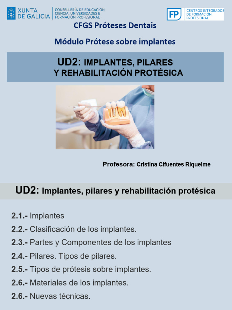 UD2. -Implantes_pilares_rehabilitación_protésica ...