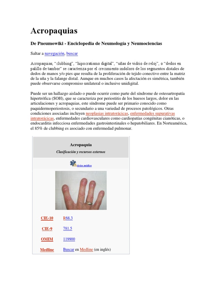 Acropaquias, "Clubbing", "Hipocratismo Digital", "Uñas de Vidrio de ...