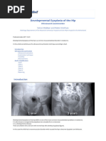 Graf Classification of Hip Dysplasia | PDF