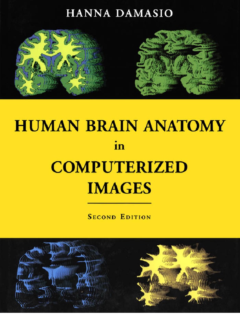 Human Brain Anatomy in Computerized Images - Hanna Damasio | PDF