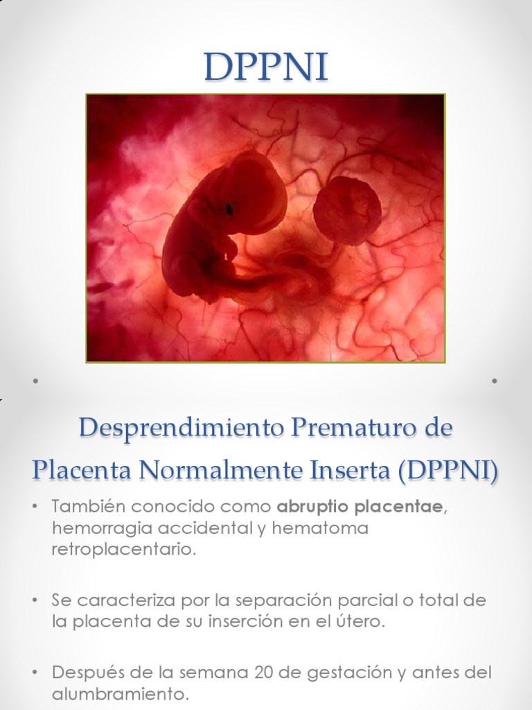 DPPNI | PDF | Placenta | Parto prematuro