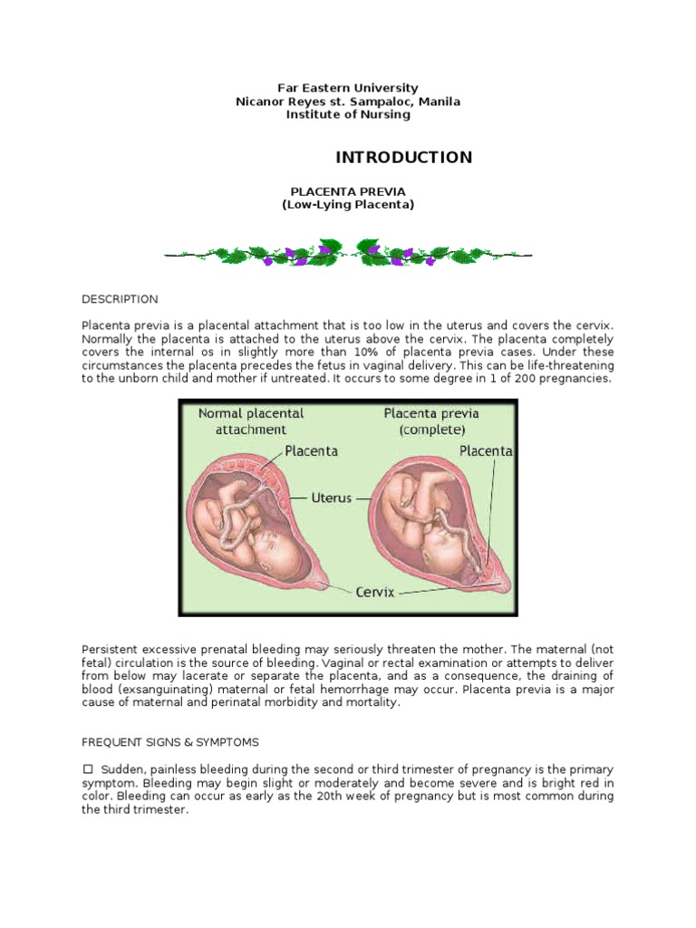 Nursing Process - Placenta Previa | PDF | Labia | Uterus