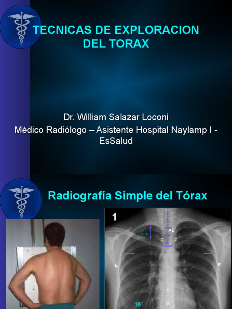 Tecnica Exploracion Torax | Tórax | Pulmón