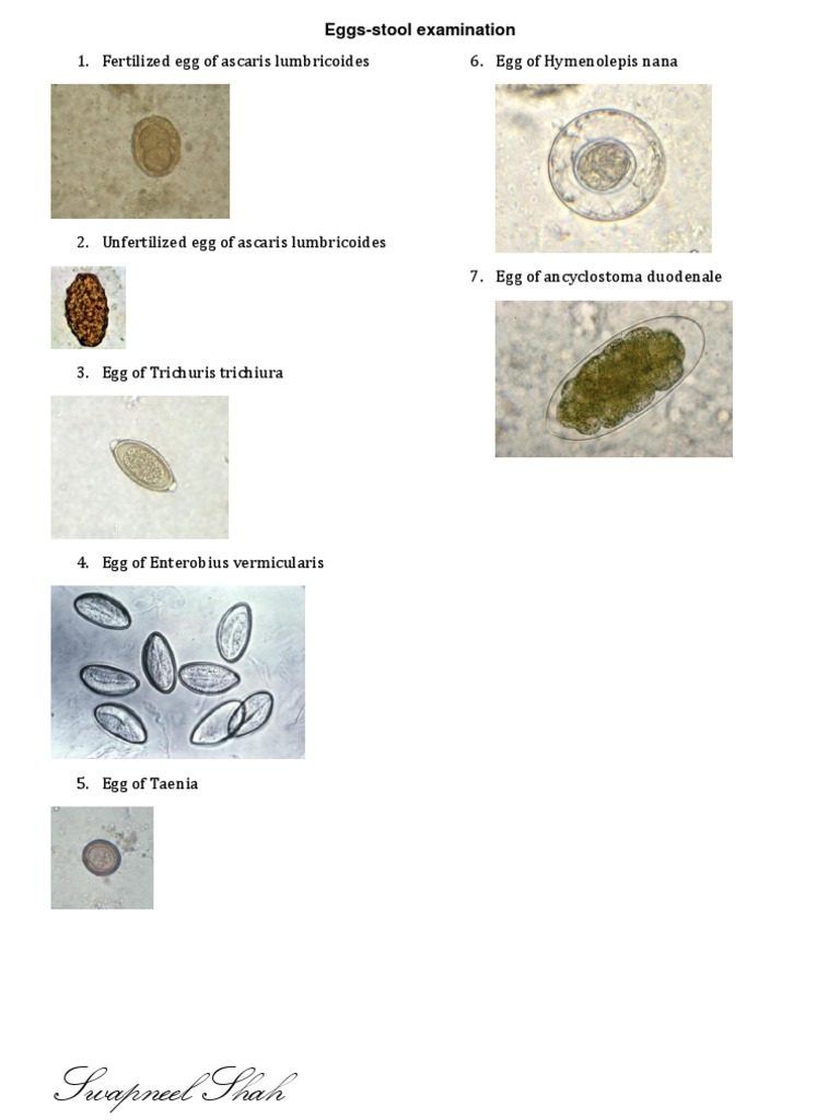 Eggs Stool Examination | PDF