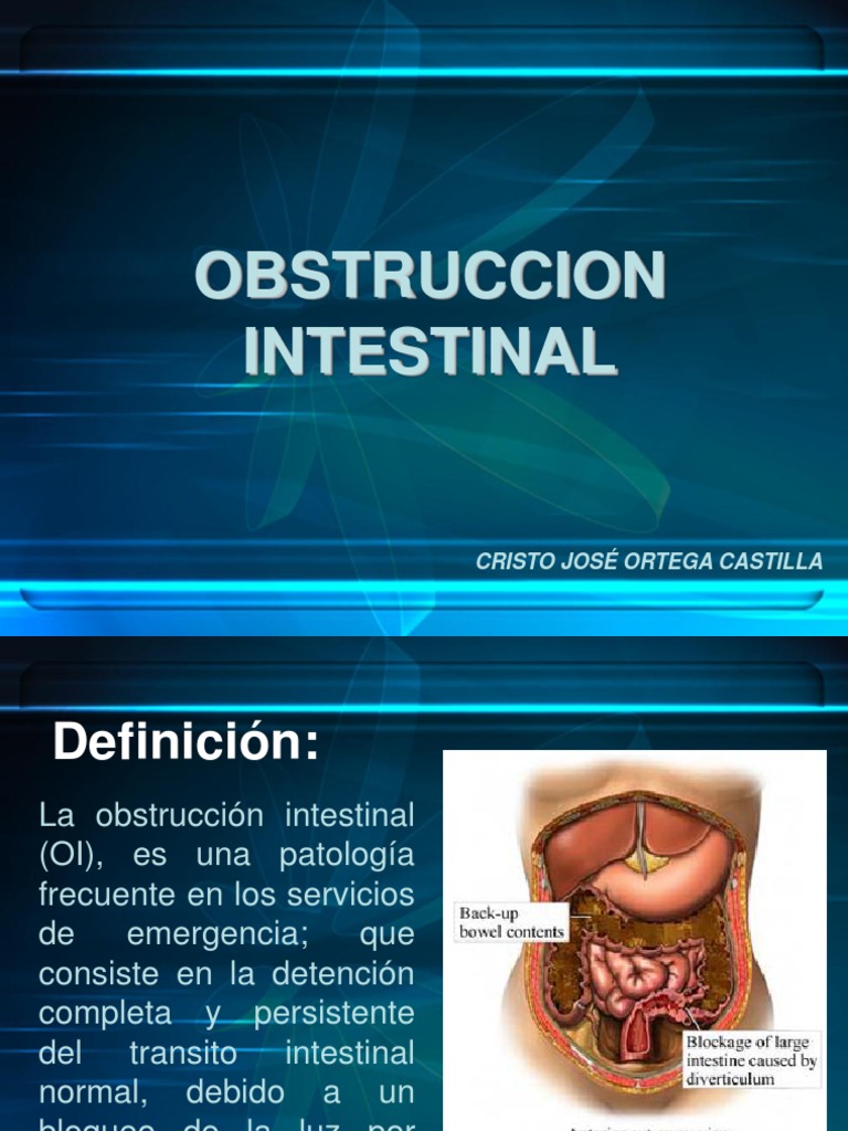 Obstruccion Intestinal | PDF | Gastroenterología | Medicina
