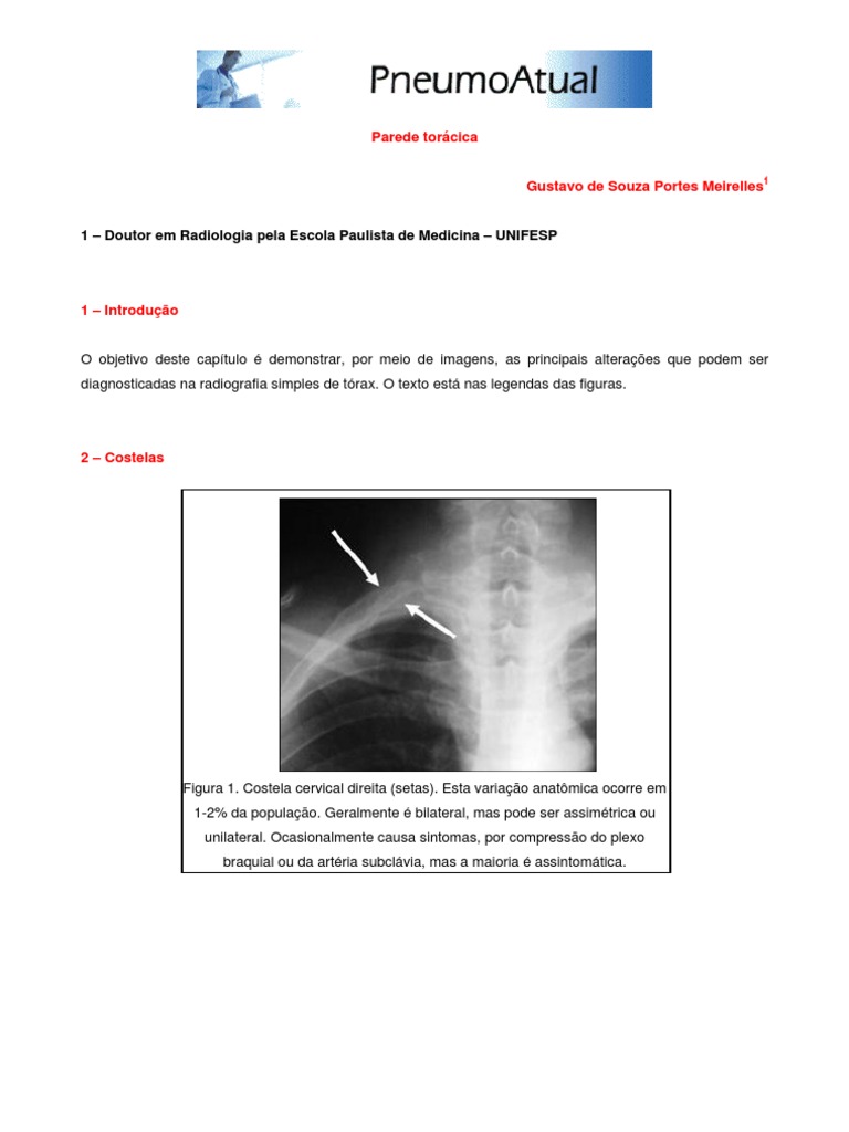 RX Tórax - Parede Torácica | PDF | Remédio | Medicina Clínica