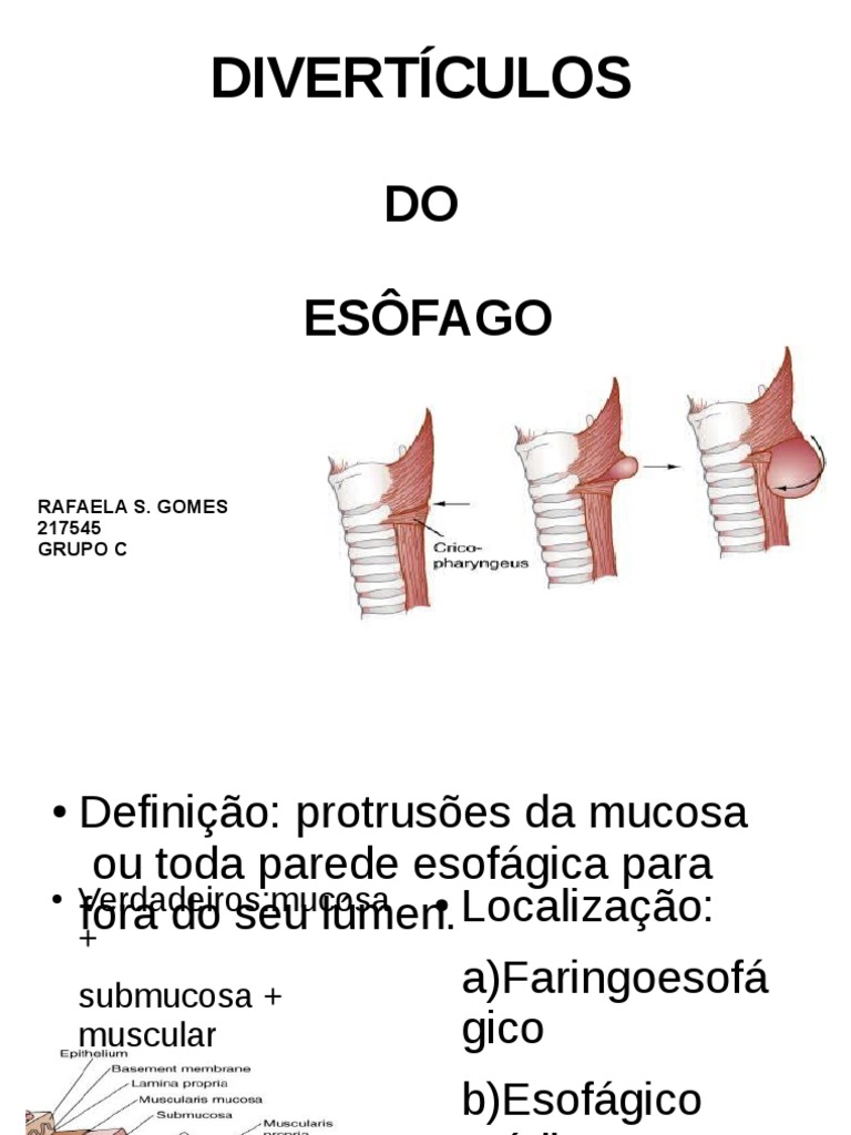 Divertículos Do Esôfago Final | PDF | Doenças e distúrbios | Doenças ...