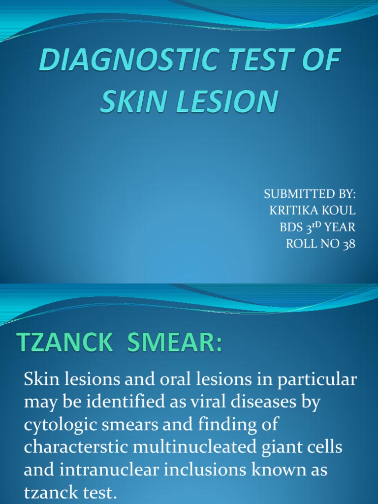 38 Tzanck Smear, Auspitz Sign, Nikolsky Sign, Le Cell $ Koebners ...