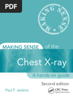 ACR 2023 Lung RADS | PDF | Ct Scan | Radiology