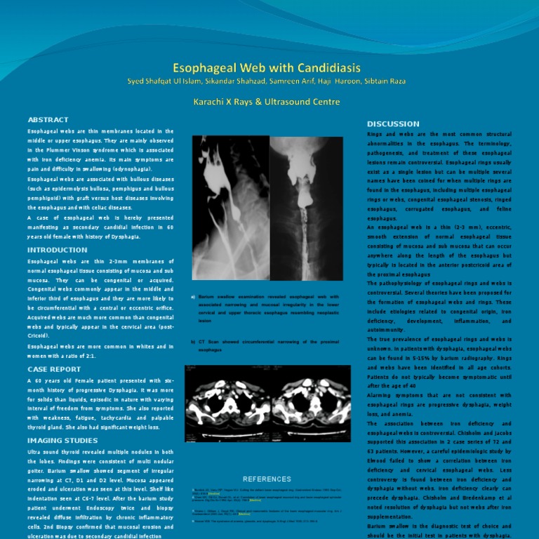 Esophageal Web Final | Esophagus | Gastroenterology