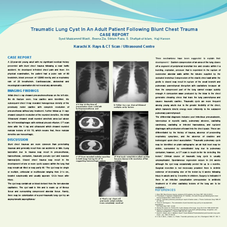 Traumatic Lung Cyst Post Chest Injury | PDF | Lung | Thorax