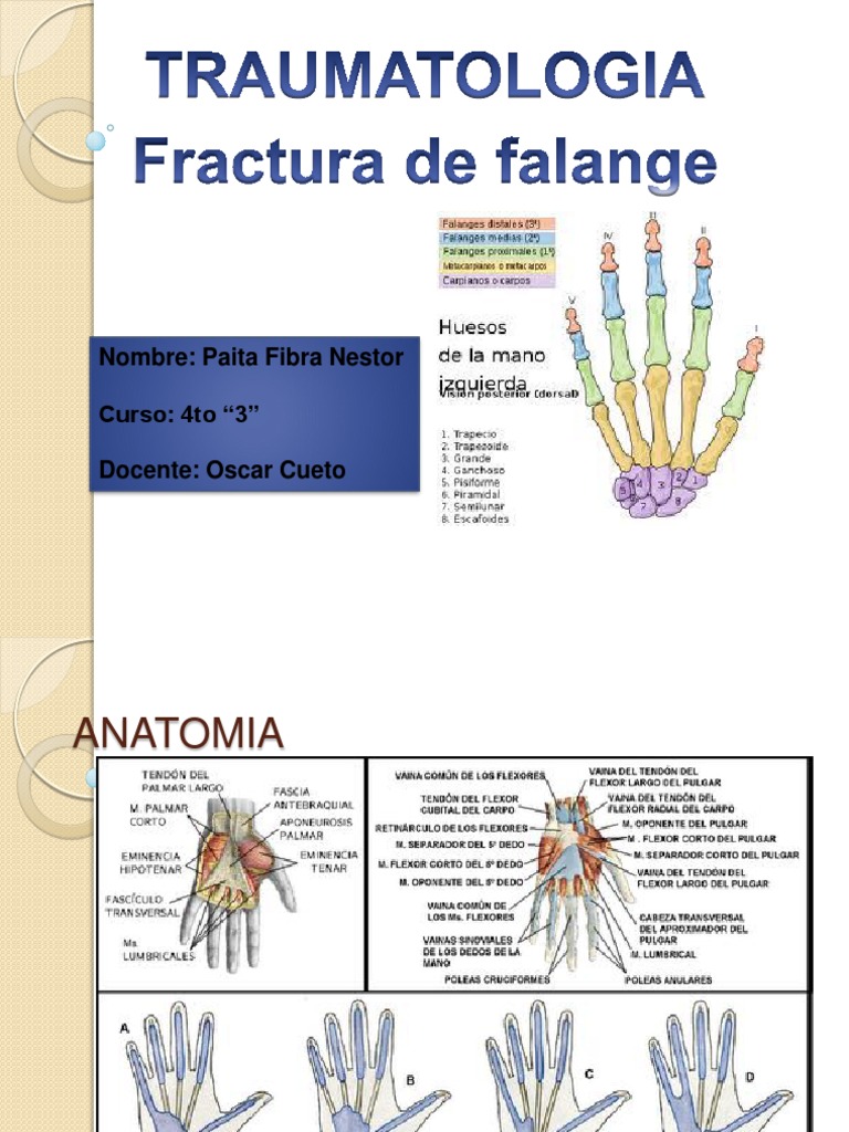Fractura de Falanges