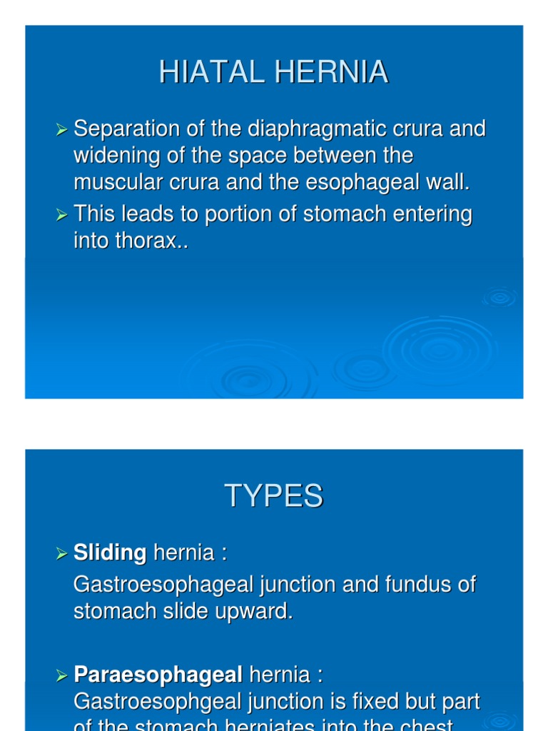 Hiatal Hernia | PDF | Esophageal Cancer | Esophagus
