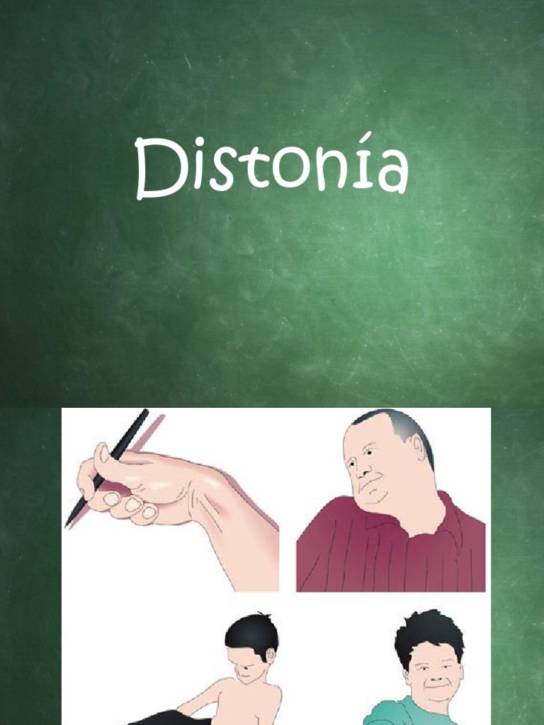 Distonía | PDF | Distonia | Enfermedades y trastornos humanos