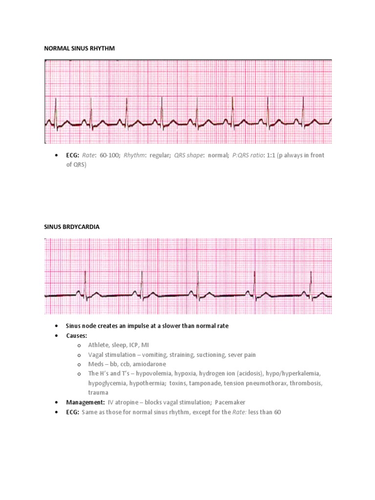 ECG Strips | Heart | Cardiovascular System
