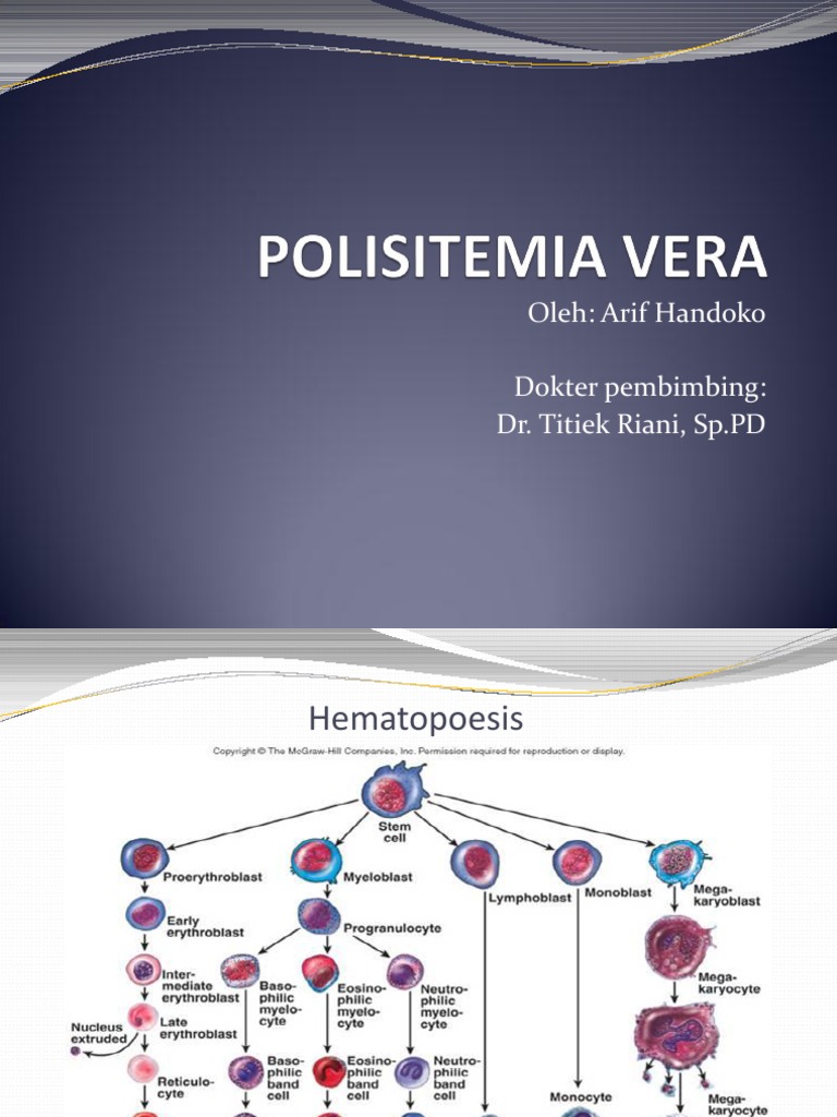 Polisitemia Vera Arif | PDF